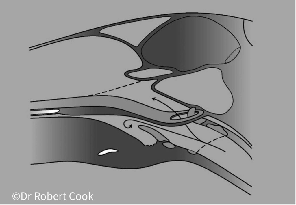 A Bit-FREE, Pain-FREE Future for the FREE-Breathing Horse